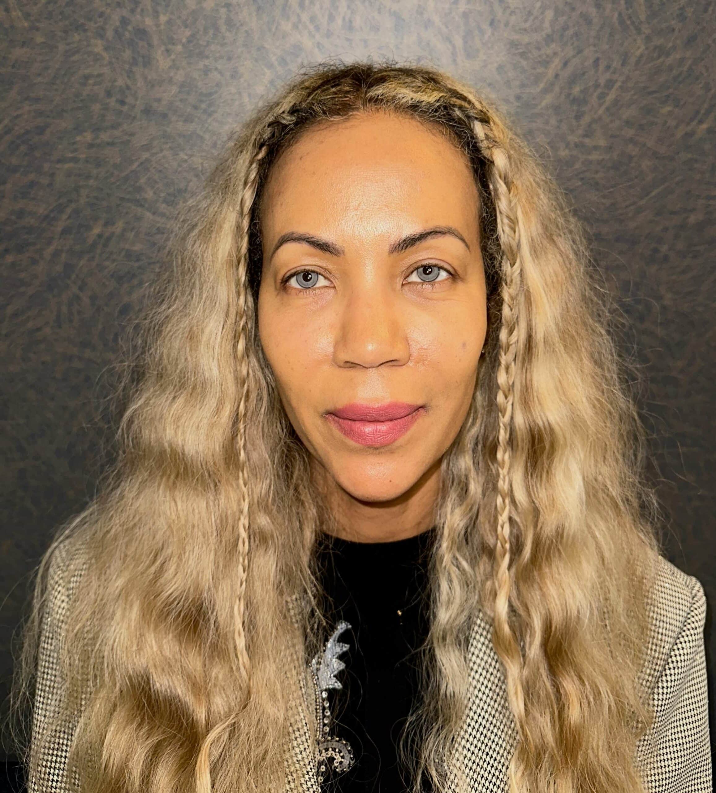 Keratopigmentation Manhattan | Manhattan LASIK Center