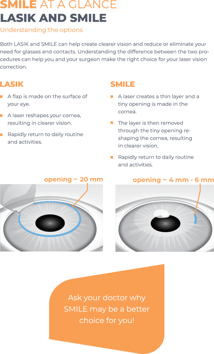 SMILE Brochures - See What SMILE Can Do For You | Manhattan LASIK Center
